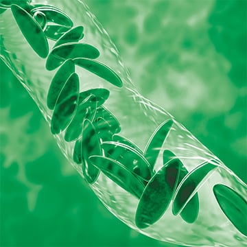 Automated Immunoassay Analyser AIA-CL300